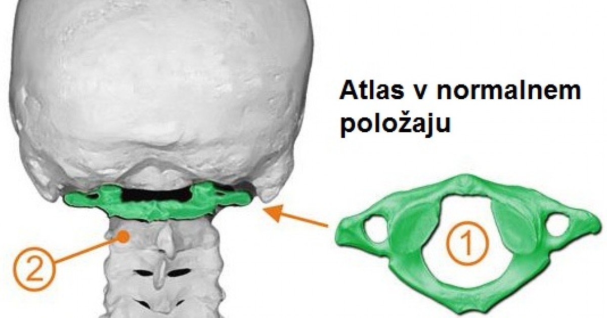 Brezplačni pregledi pozicije Atlasa in predavanje o Atlasu | Svetloba.si